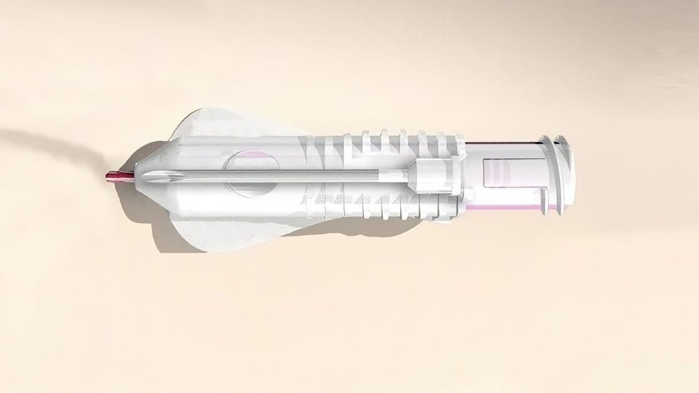Peripheral IV Catheter System - SkyDance Vascular